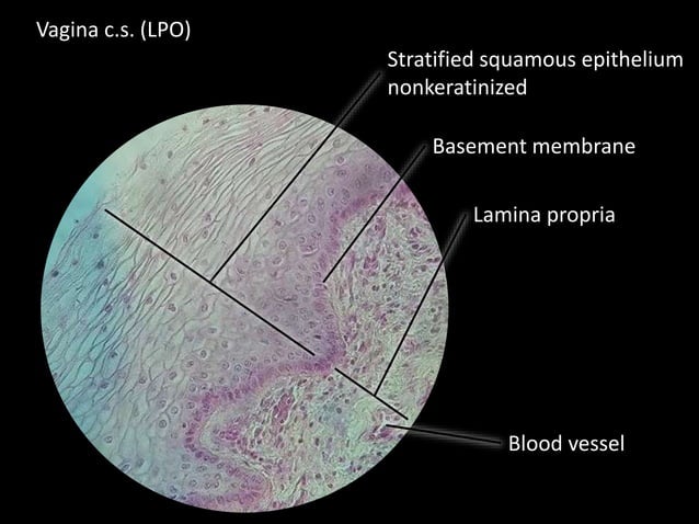 50 Shades of Pink and other Colors of Histology | PPTX