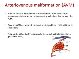 subarachnoid hemorrhage | PPT