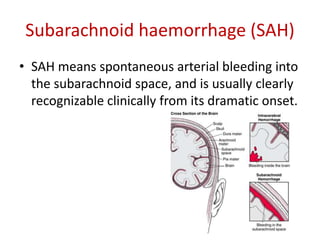 subarachnoid hemorrhage | PPT