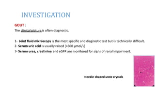 Gout | PPTX