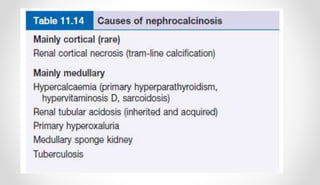 Nephrocalcinosis | PPTX