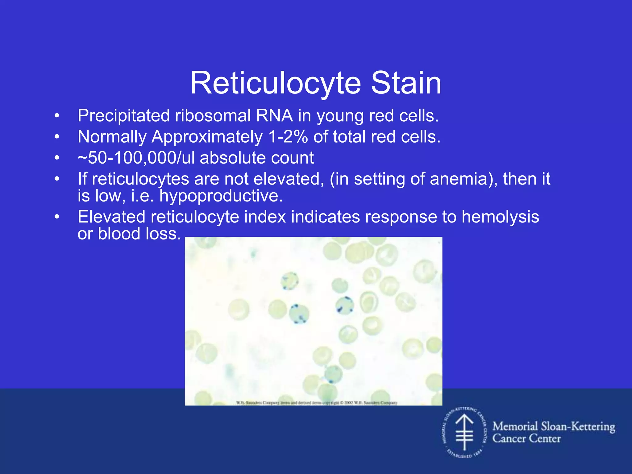 approach to the diagnosis of anemia | PPTX