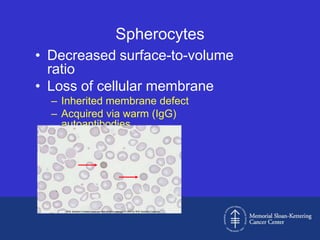 approach to the diagnosis of anemia | PPTX