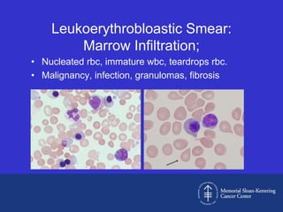 approach to the diagnosis of anemia | PPTX