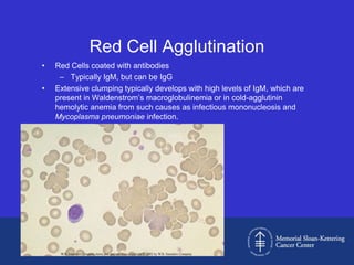 approach to the diagnosis of anemia | PPTX