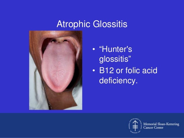 approach to the diagnosis of anemia