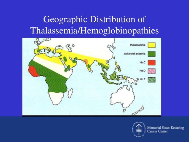 thalassemia