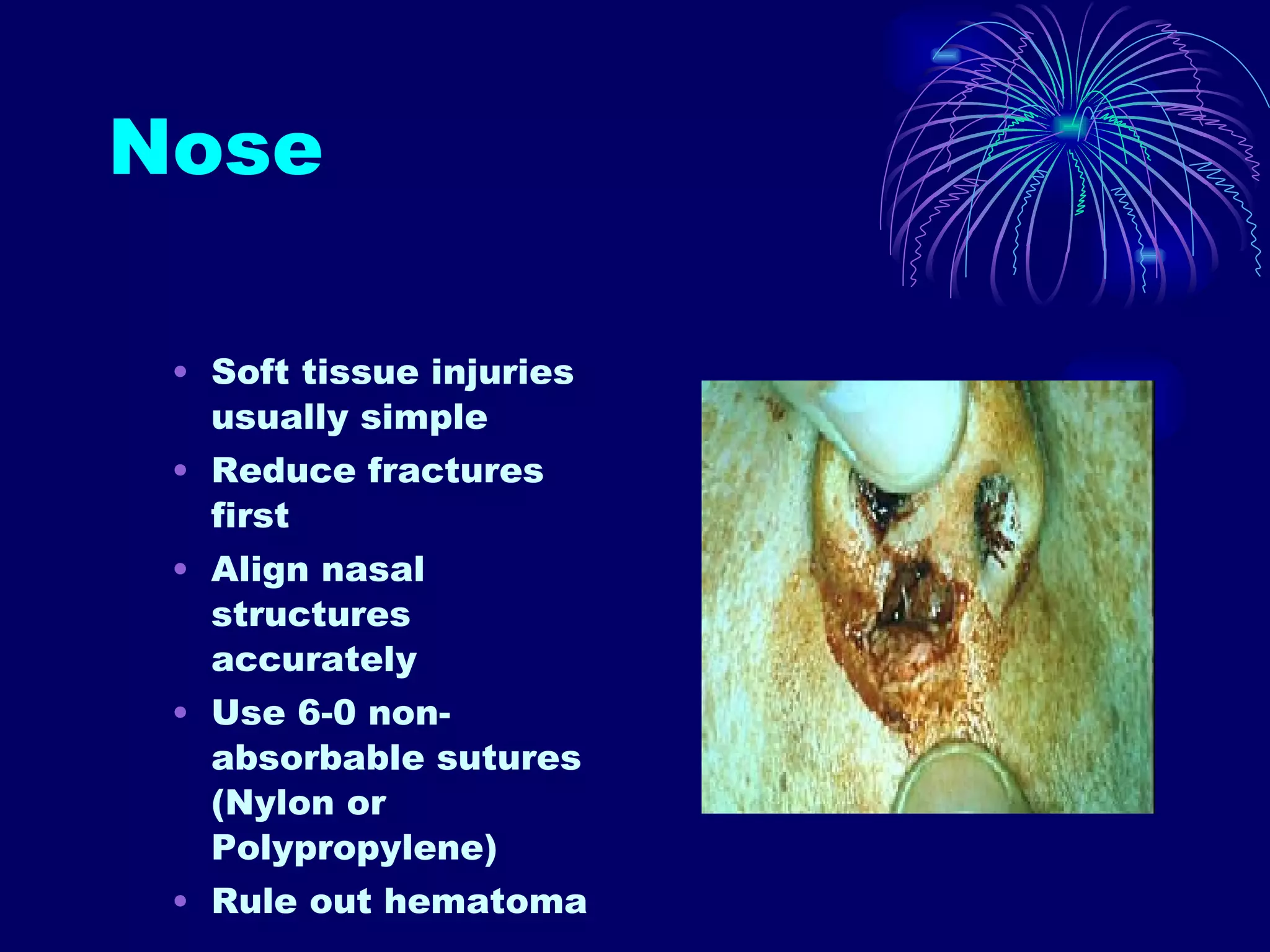 Soft Tissue Facial Injuries By Sa | PPT