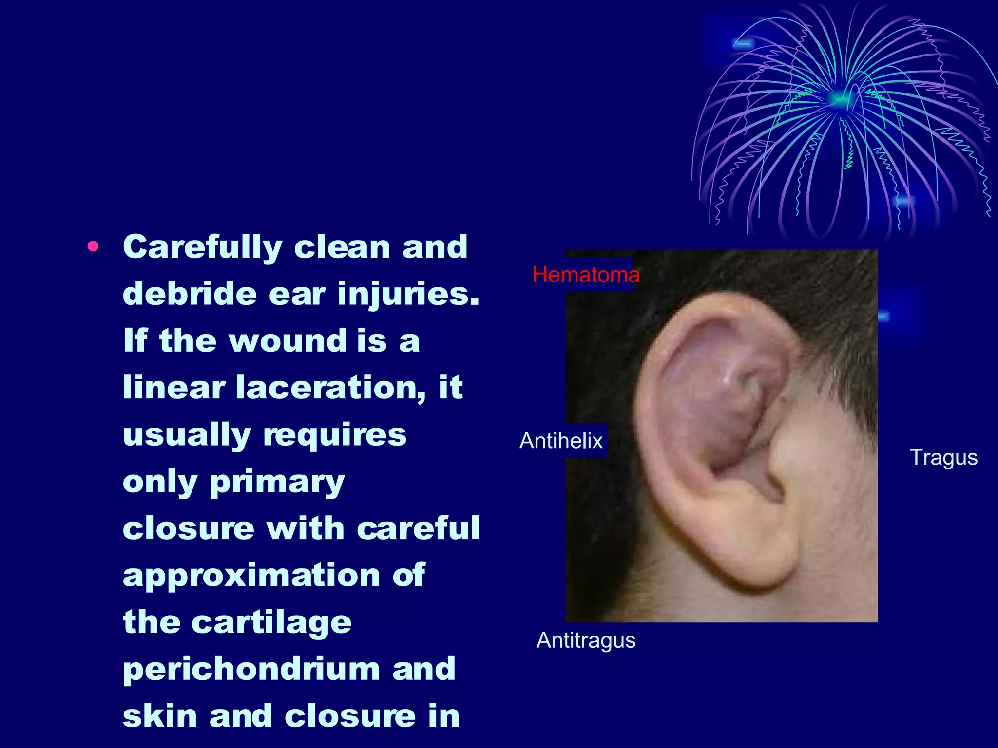 Soft Tissue Facial Injuries By Sa | PPT