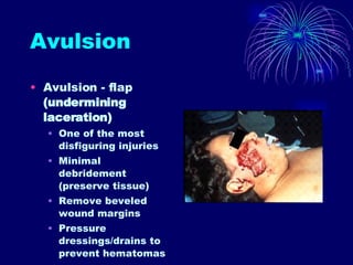 Soft Tissue Facial Injuries By Sa | PPT