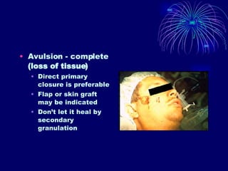 Soft Tissue Facial Injuries By Sa | PPT