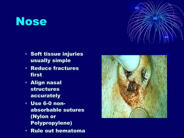 Soft Tissue Facial Injuries By Sa | PPT