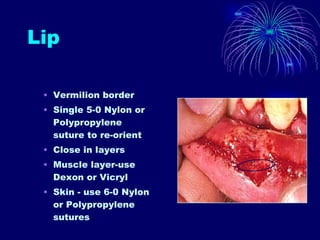 Soft Tissue Facial Injuries By Sa | PPT