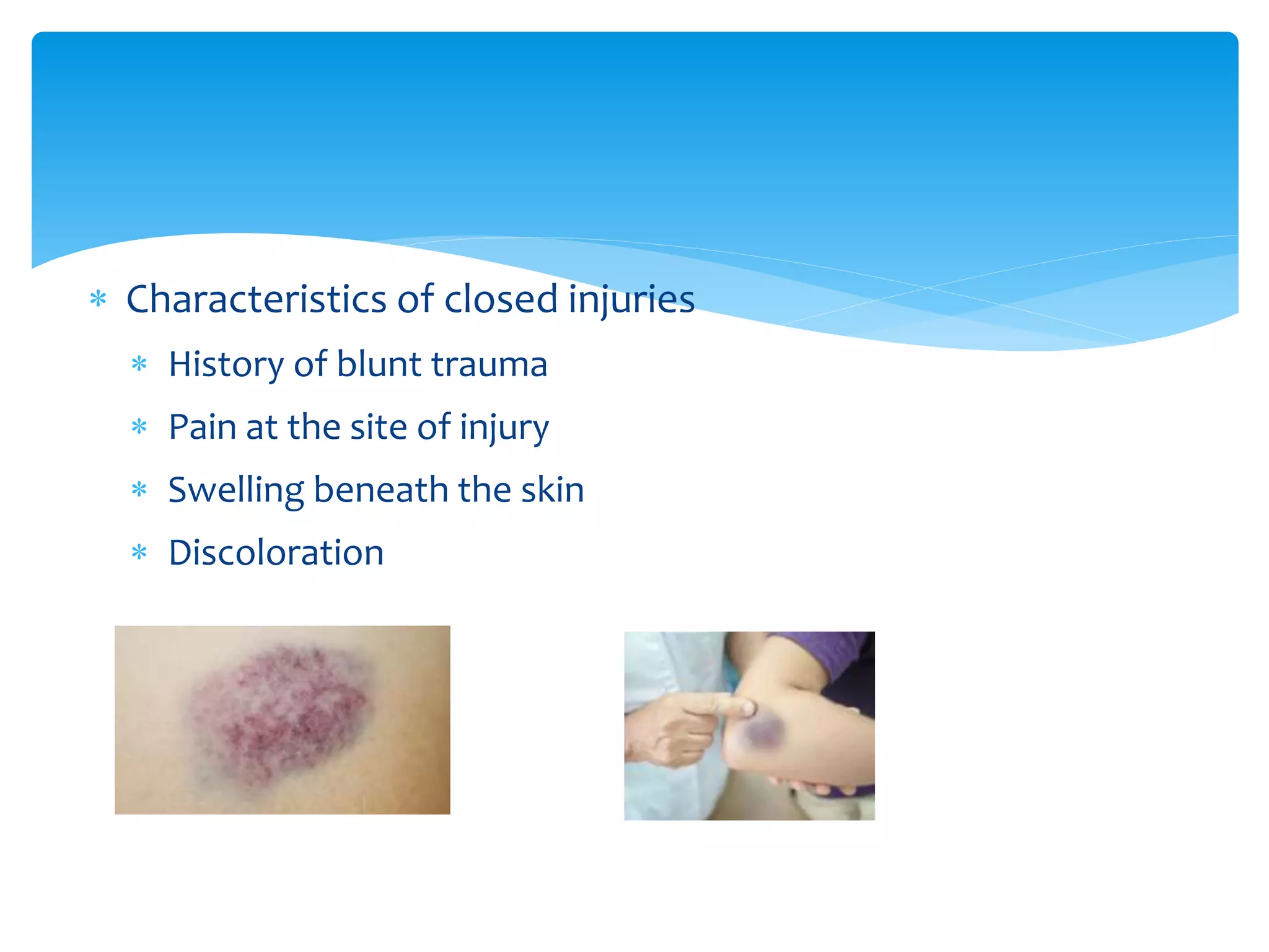 Soft-Tissue Injuries | PPTX