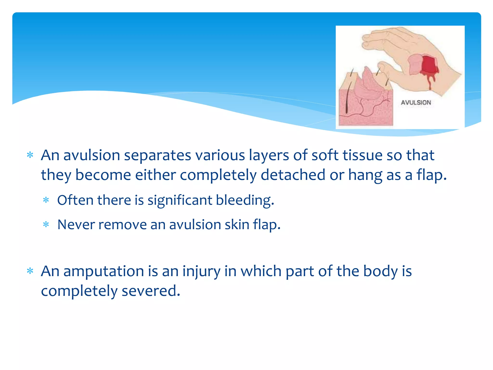 Soft-Tissue Injuries | PPTX