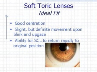fitting soft toric lenses | PPT