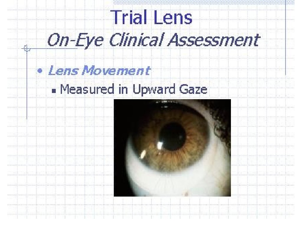 fitting soft toric lenses