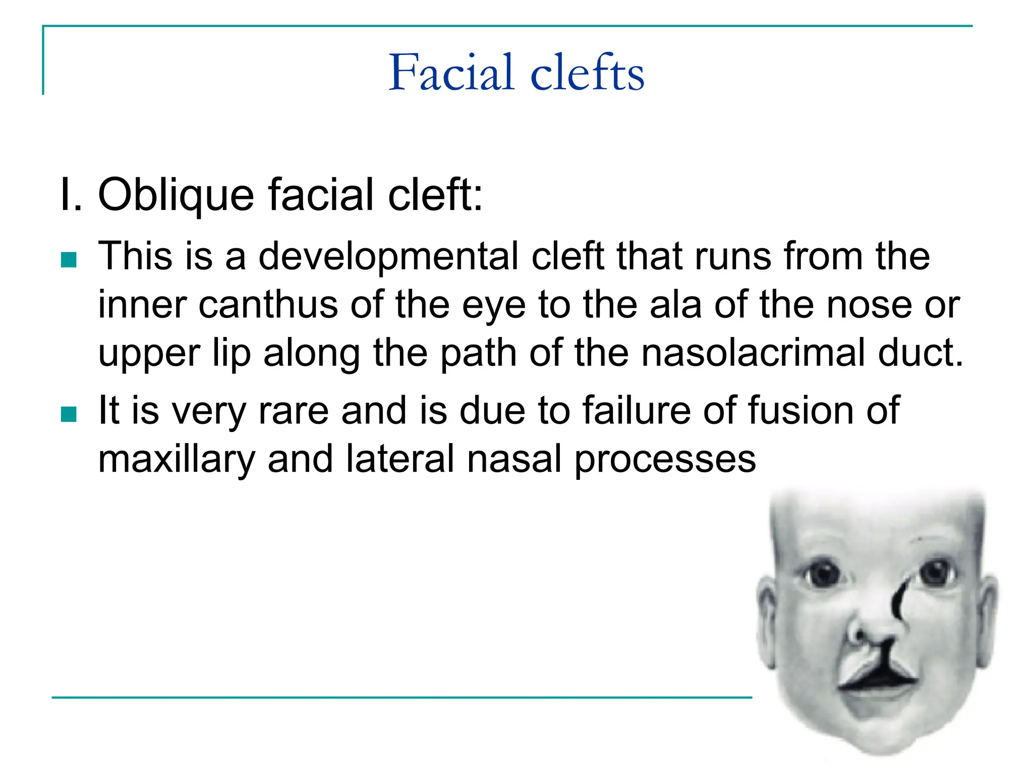 Soft anomalies pdf . Oral pathology . Dental study | PDF