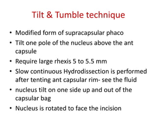 Soft lens should not be a hard work | PPT