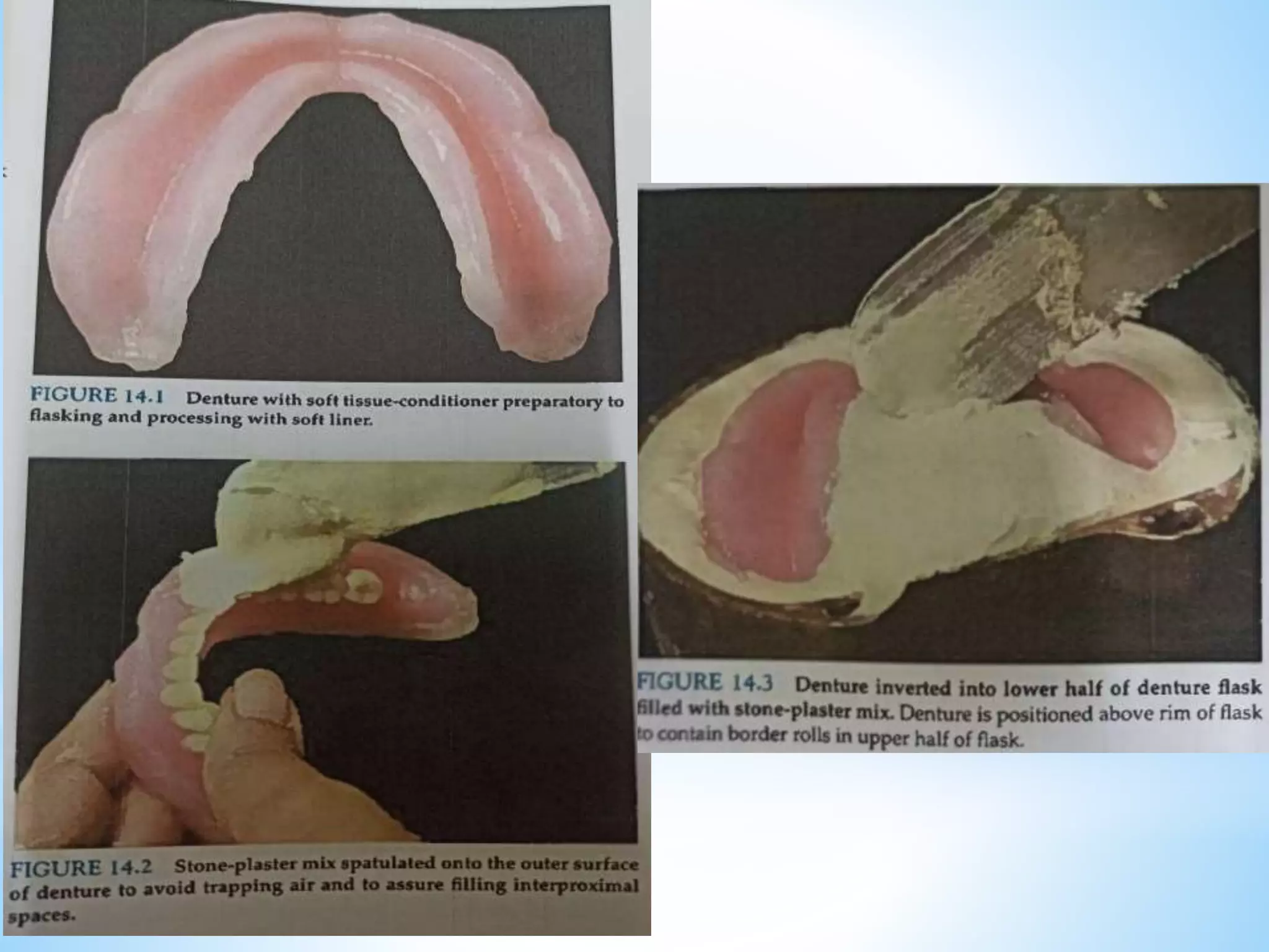 Soft liners and tissue conditioners | PPTX