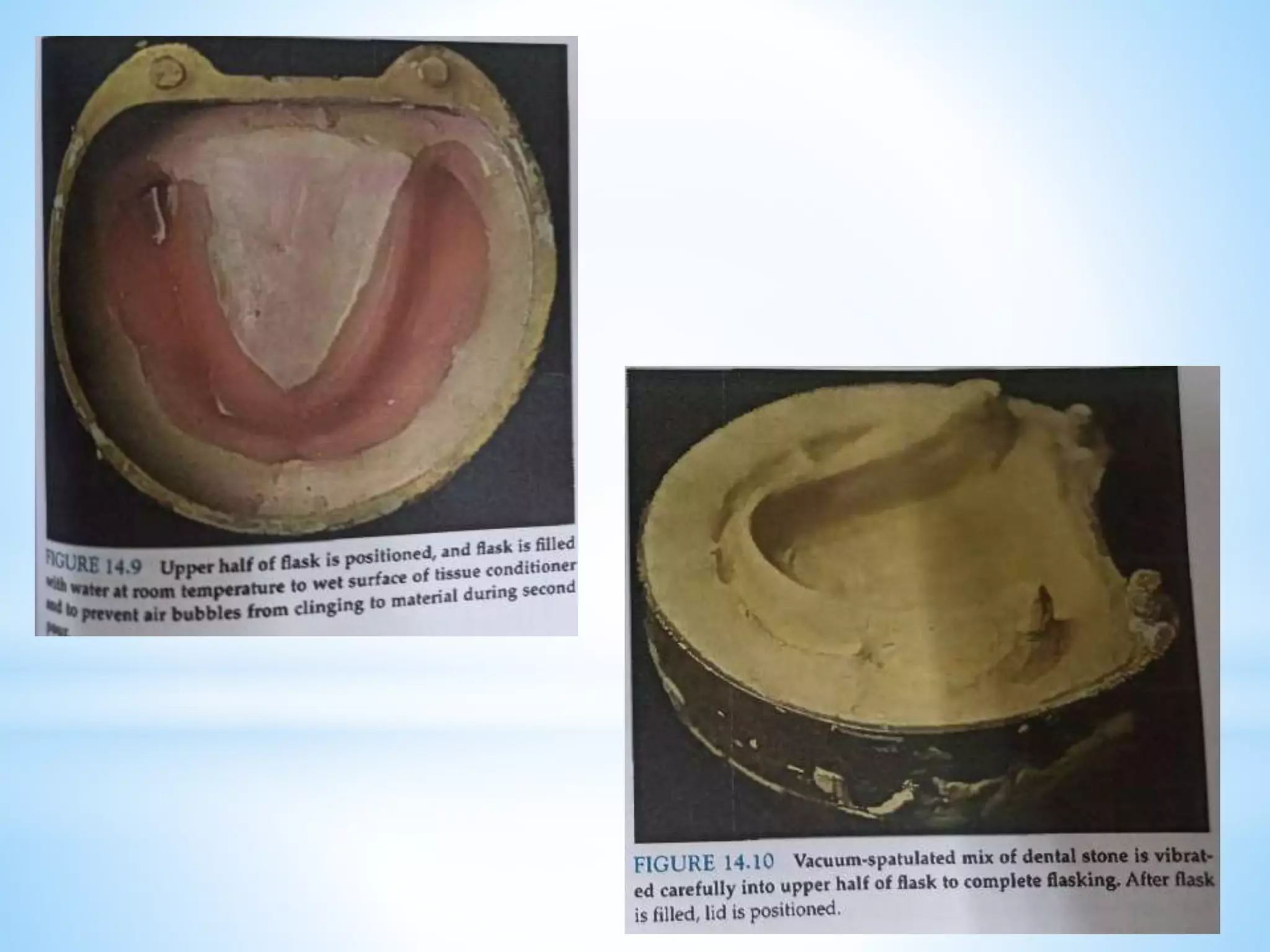 Soft liners and tissue conditioners | PPTX