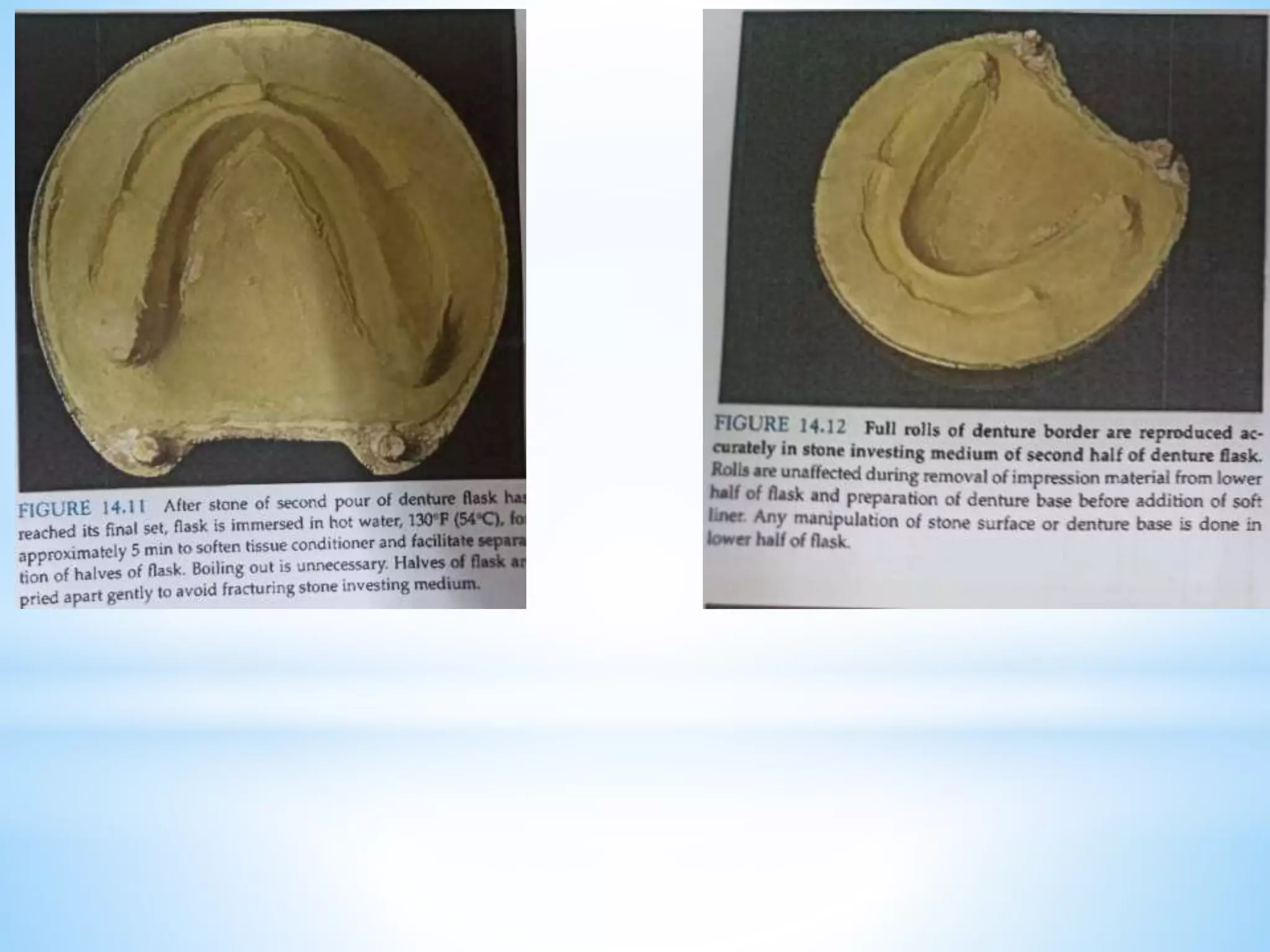 Soft liners and tissue conditioners | PPTX