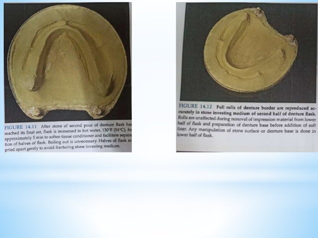 Soft liners and tissue conditioners | PPTX | Dental Health | Diseases ...