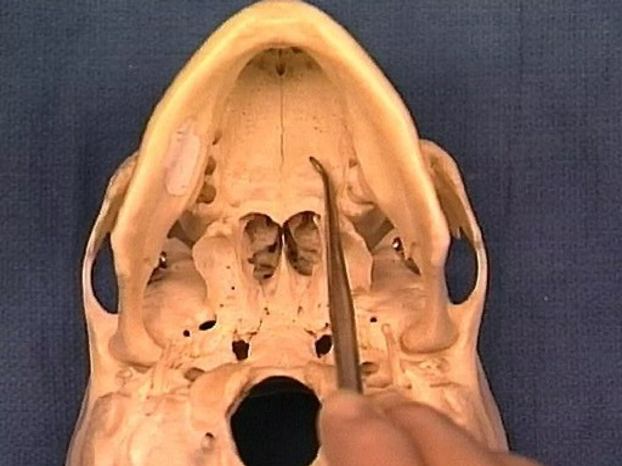 Anatomy of Soft palate | PPT