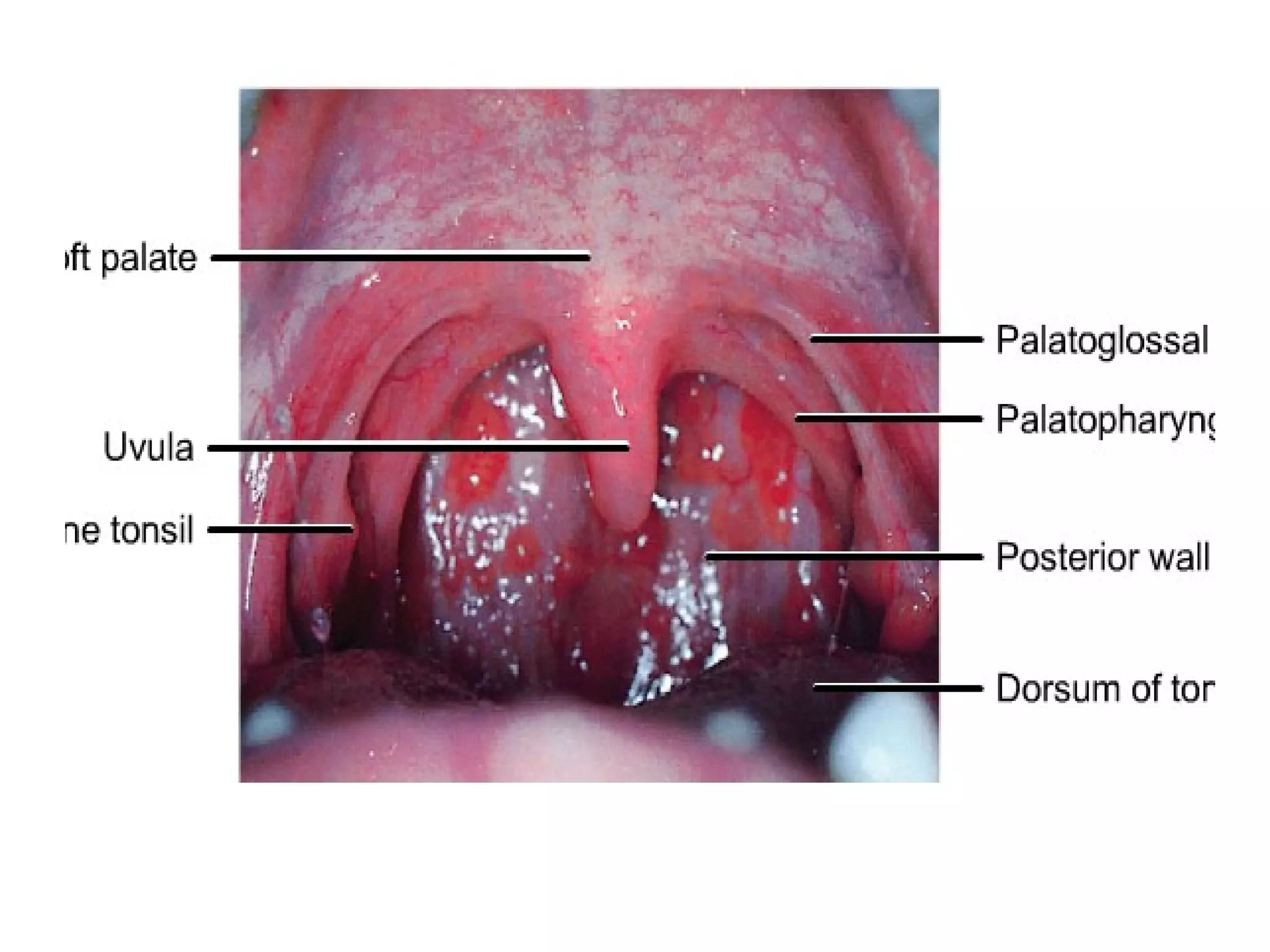 Anatomy of Soft palate | PPT