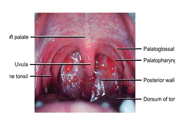 Anatomy Of Soft Palate Ppt