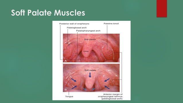 Soft Palate anatomy muscles blood supplies and innervations.pptx