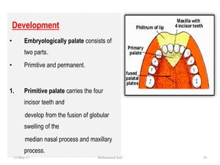 Soft palate for MBBS | PDF