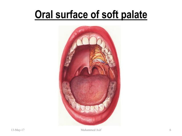 Soft palate for MBBS | PDF | Ear, Nose and Throat Conditions | Diseases ...