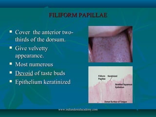Soft palate,tongue ,floor of the mouth/ dental crown & bridge courses | PPT
