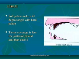 Soft palate,tongue ,floor of the mouth/ dental crown & bridge courses | PPT