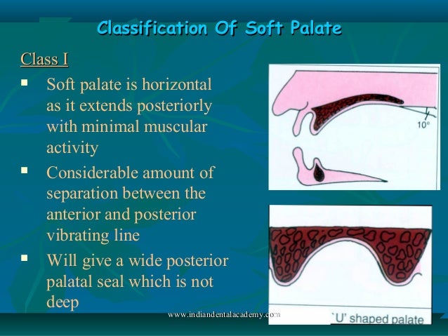 Soft palate,tongue ,floor of the mouth/ dental crown & bridge courses
