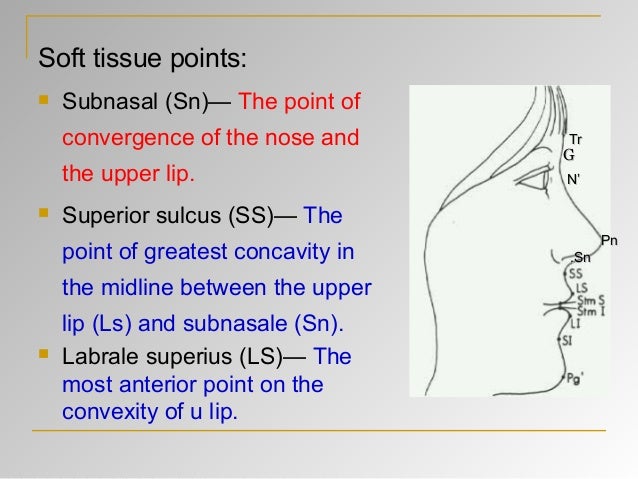 Soft tissue /certified fixed orthodontic courses by Indian dental a…