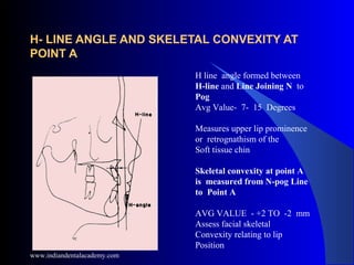 Soft tissue analysis 2 /certified fixed orthodontic courses by Indian ...