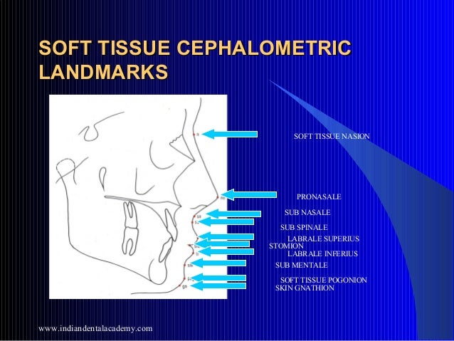 Soft tissue analysis 2 /certified fixed orthodontic courses by Indian…