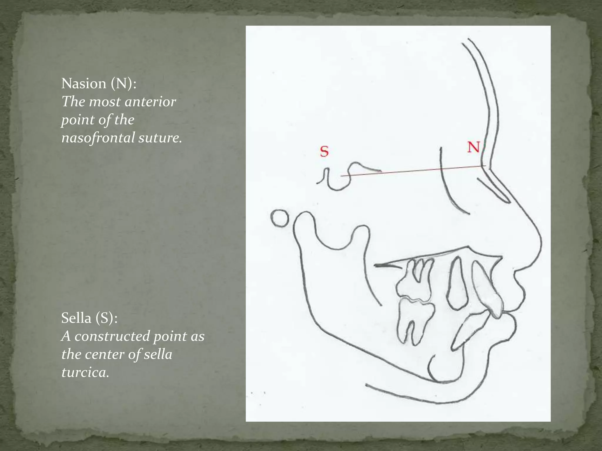 Soft tissue analysis | PPTX