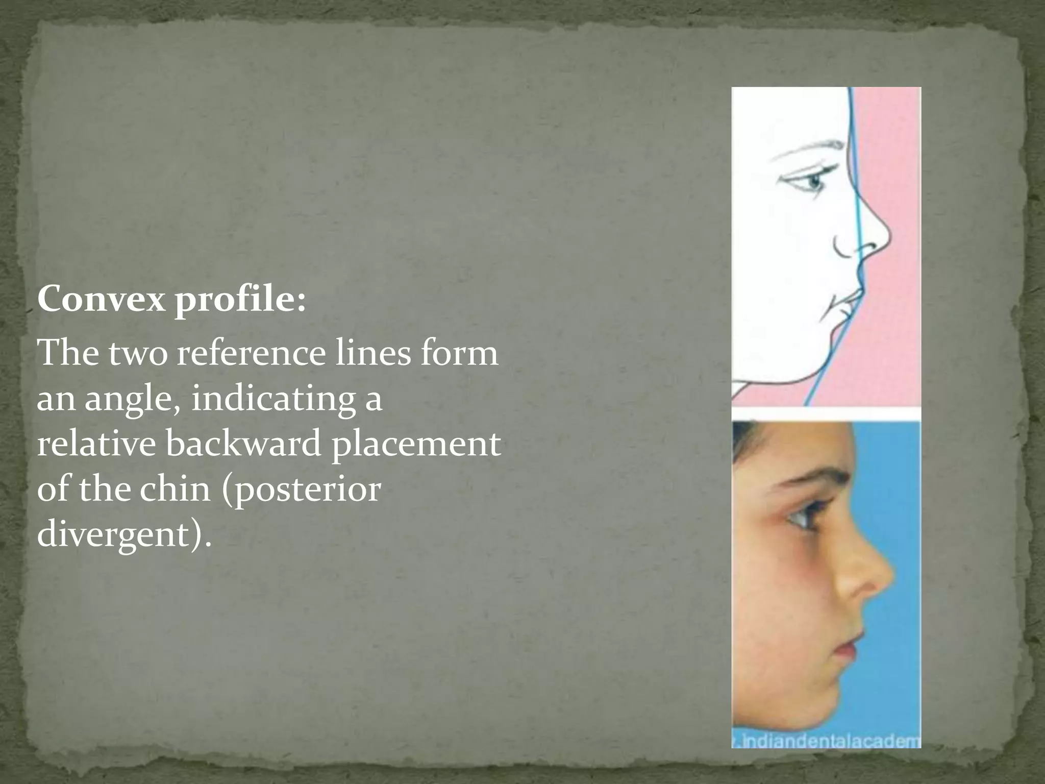 Soft tissue analysis | PPTX