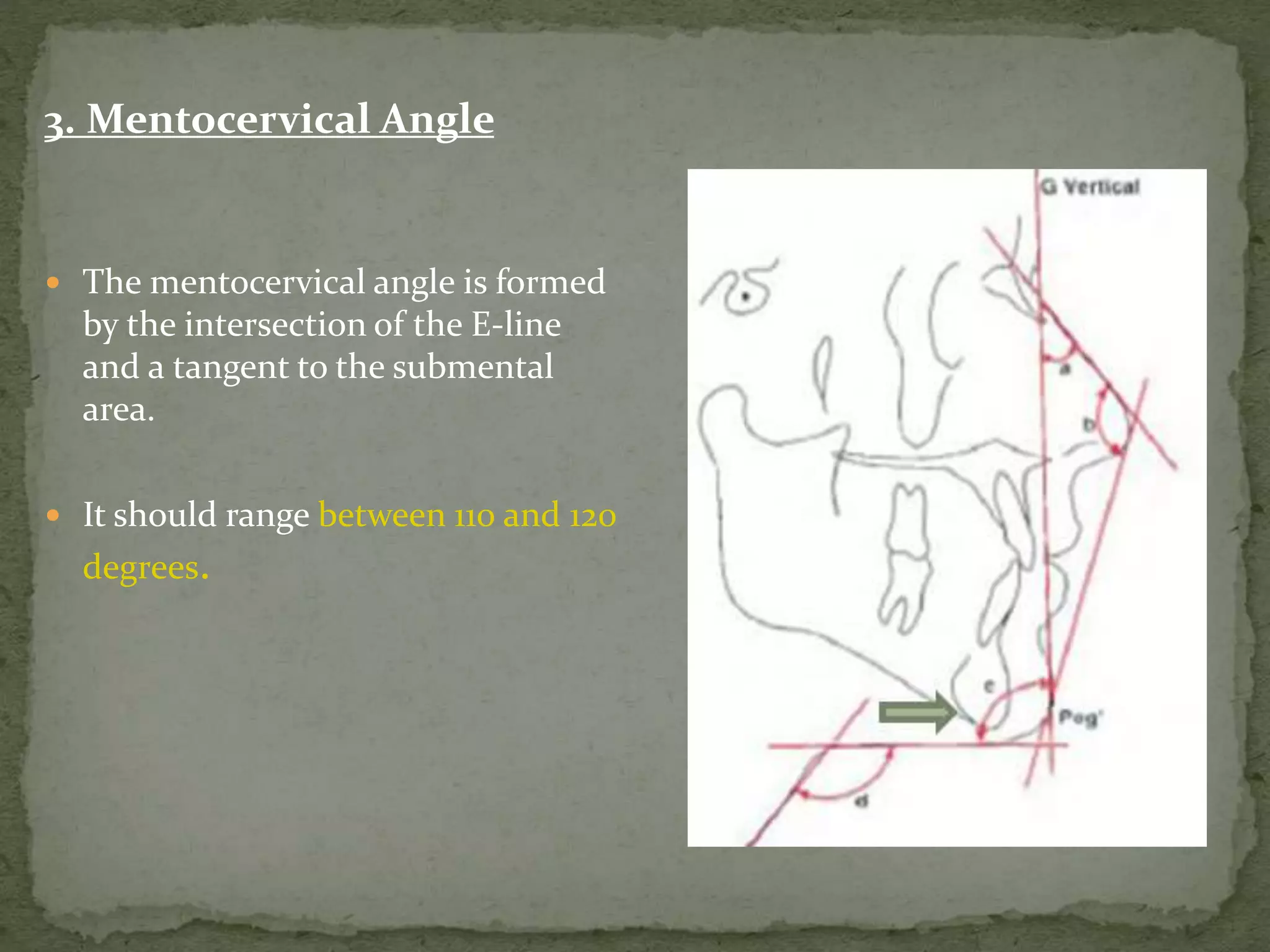 Soft tissue analysis | PPTX