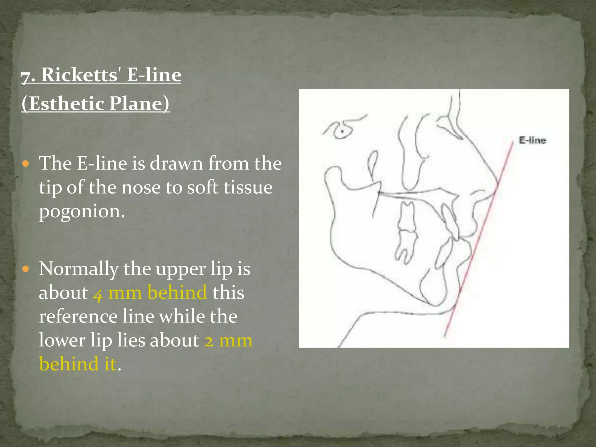 Soft tissue analysis | PPTX
