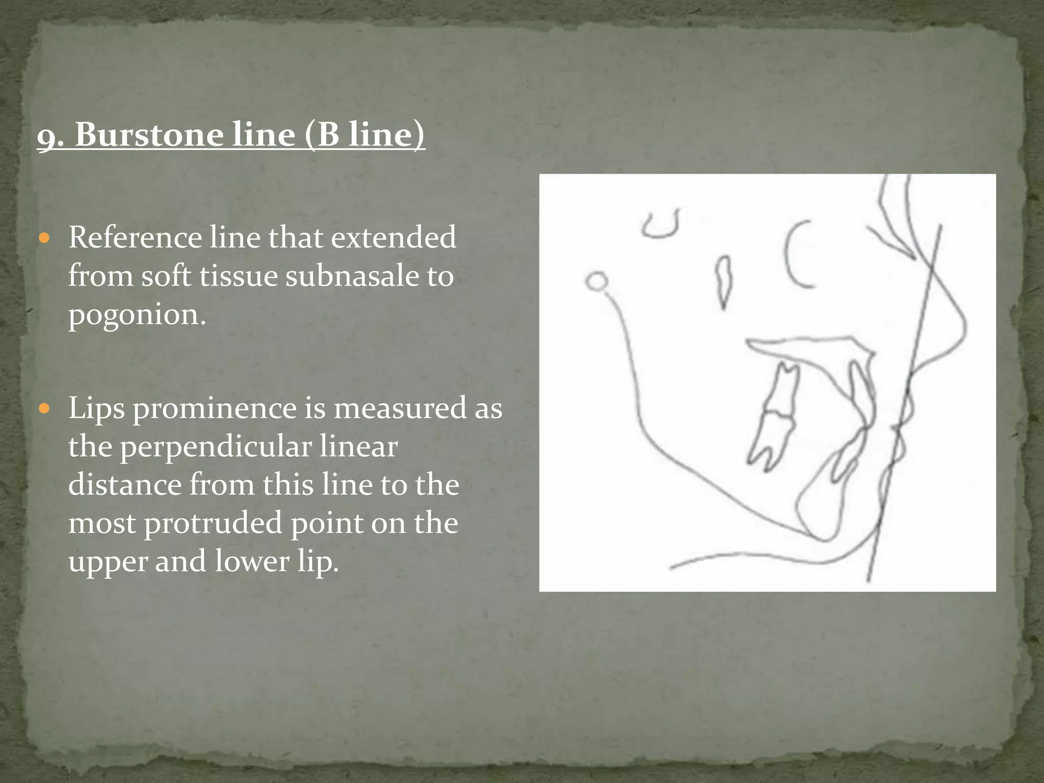 Soft tissue analysis | PPTX