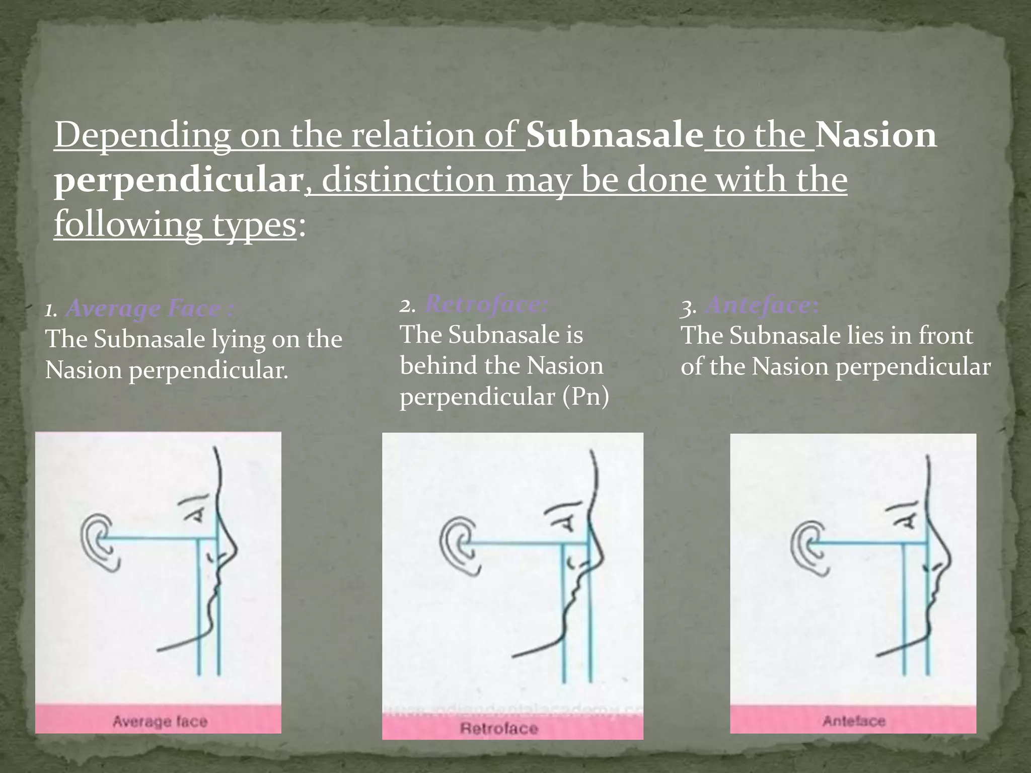 Soft tissue analysis | PPTX