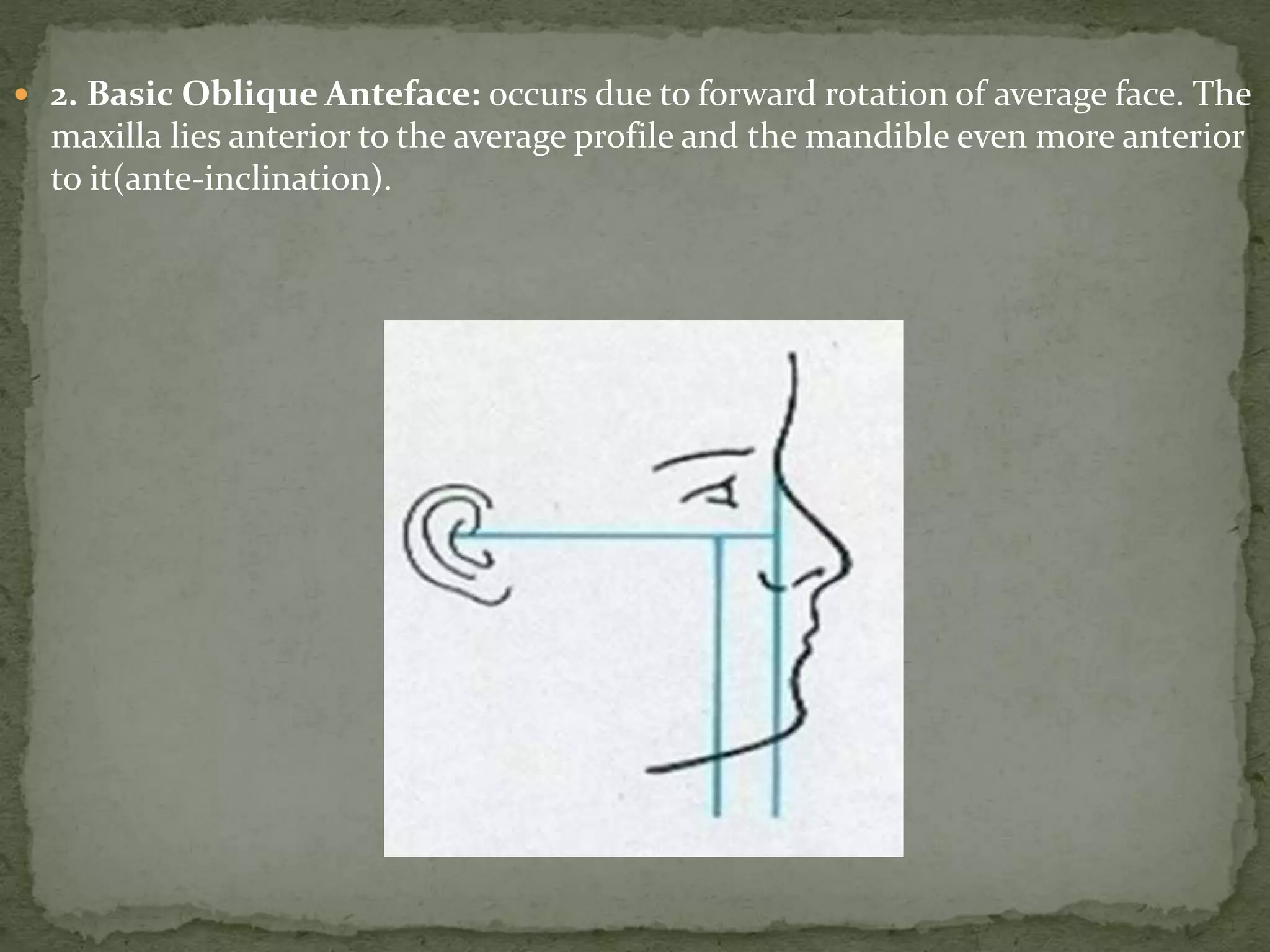 Soft tissue analysis | PPTX