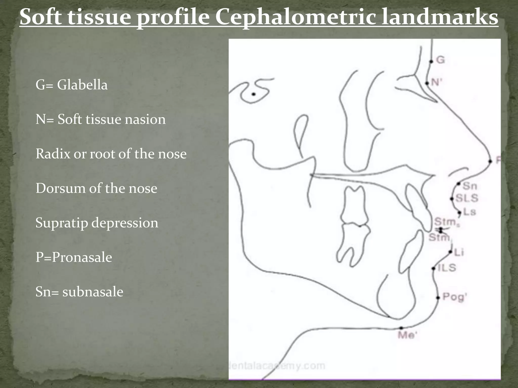 Soft tissue analysis | PPTX