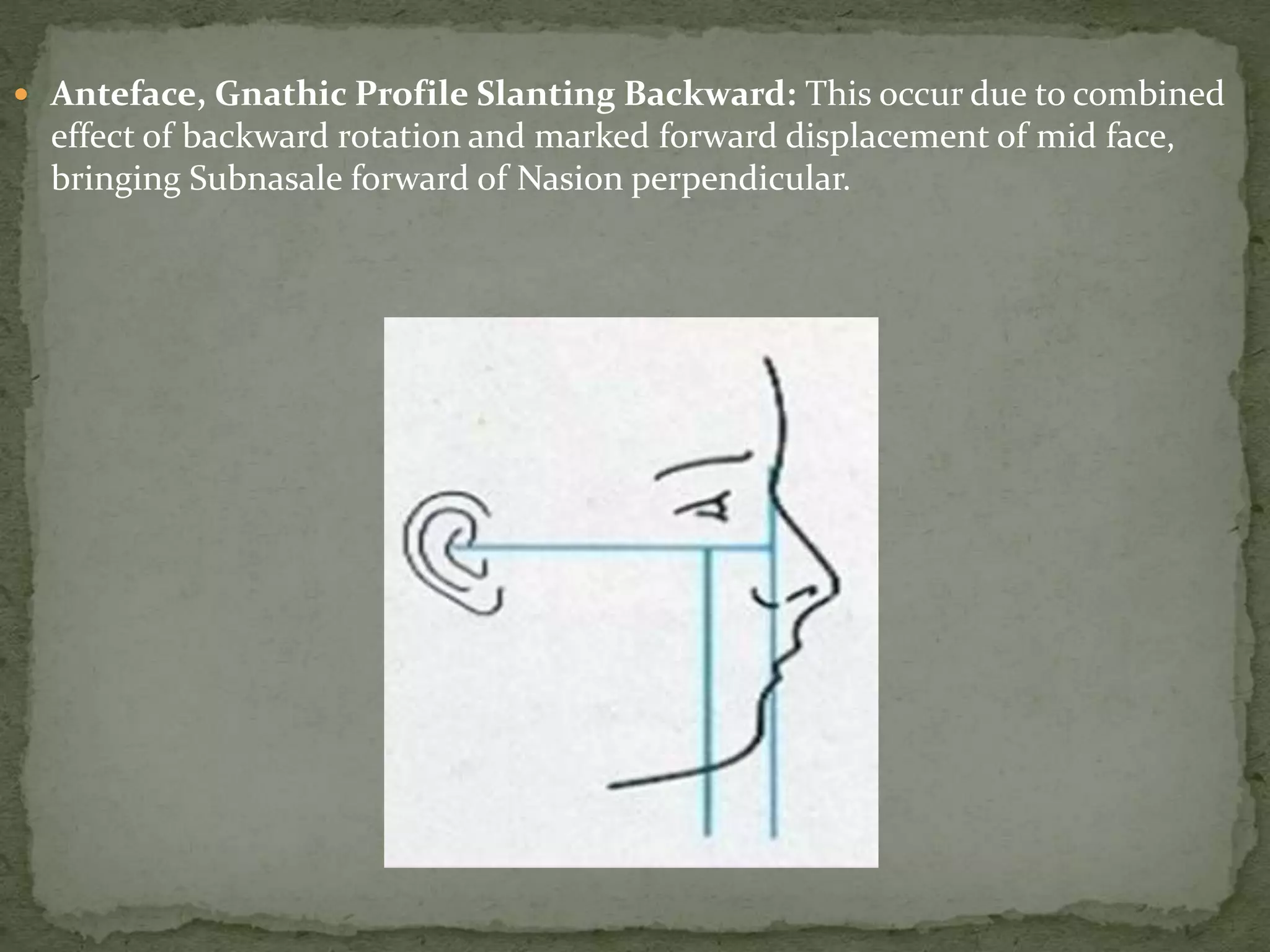 Soft tissue analysis | PPTX
