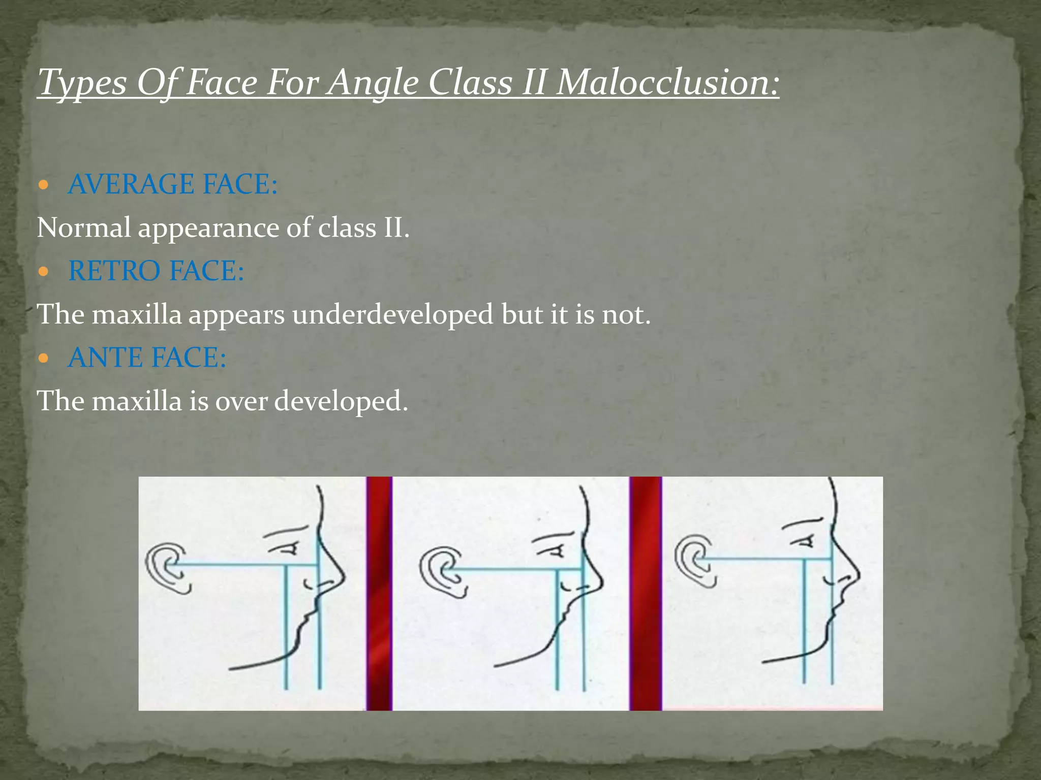 Soft tissue analysis | PPTX
