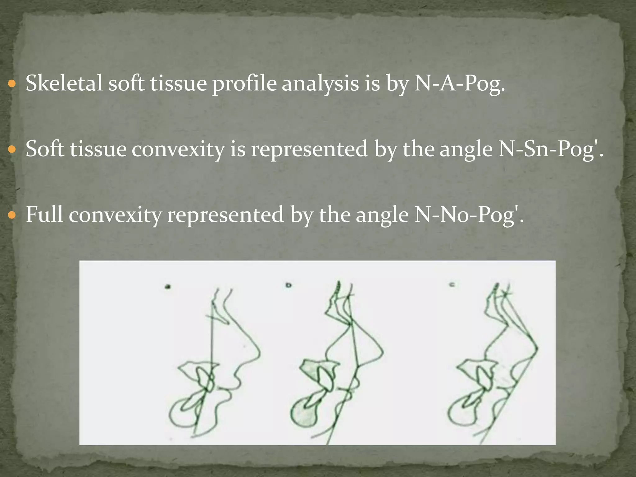 Soft tissue analysis | PPTX